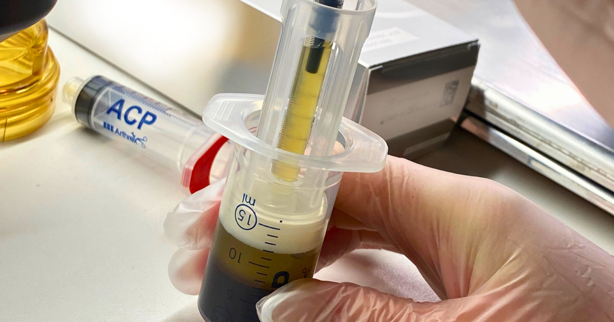 PRP for skin quality and hair loss – Vince Bertucci, MD, FRCPC ...